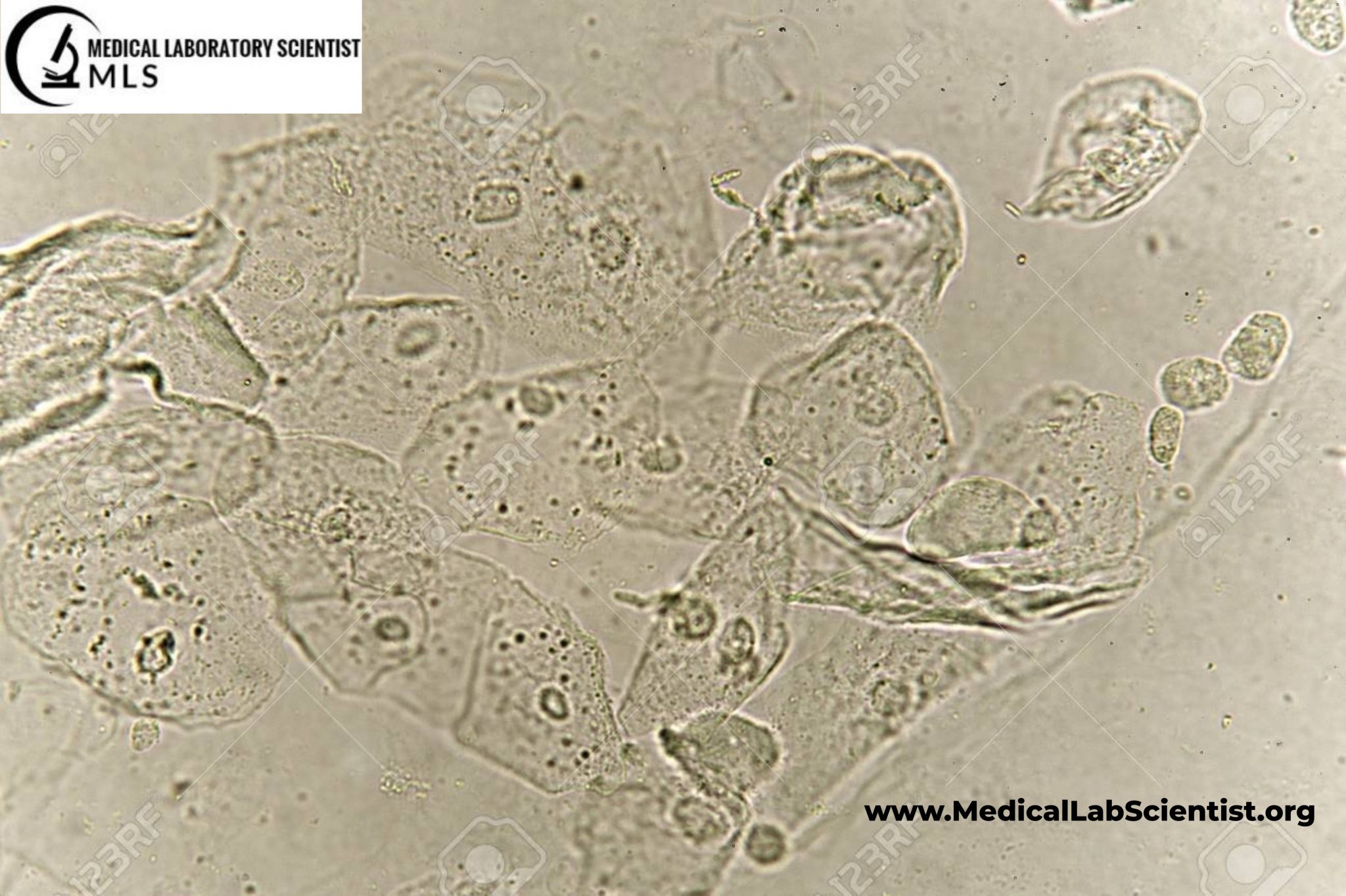 MICROSCOPIC URINALYSIS - Medical Laboratory Scientist MLS