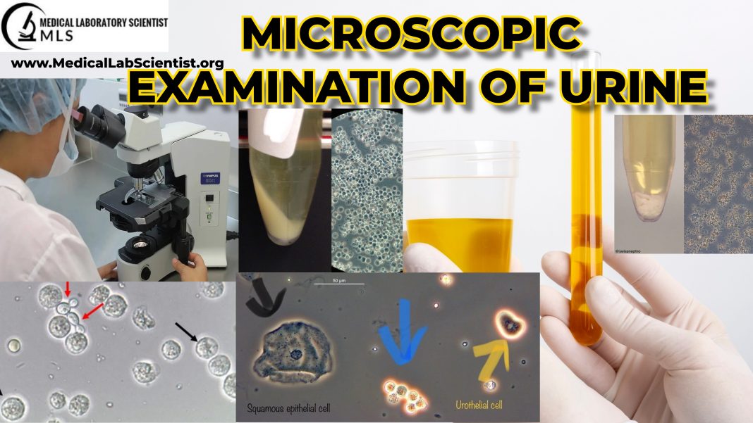 MICROSCOPIC URINALYSIS - Medical Laboratory Scientist MLS