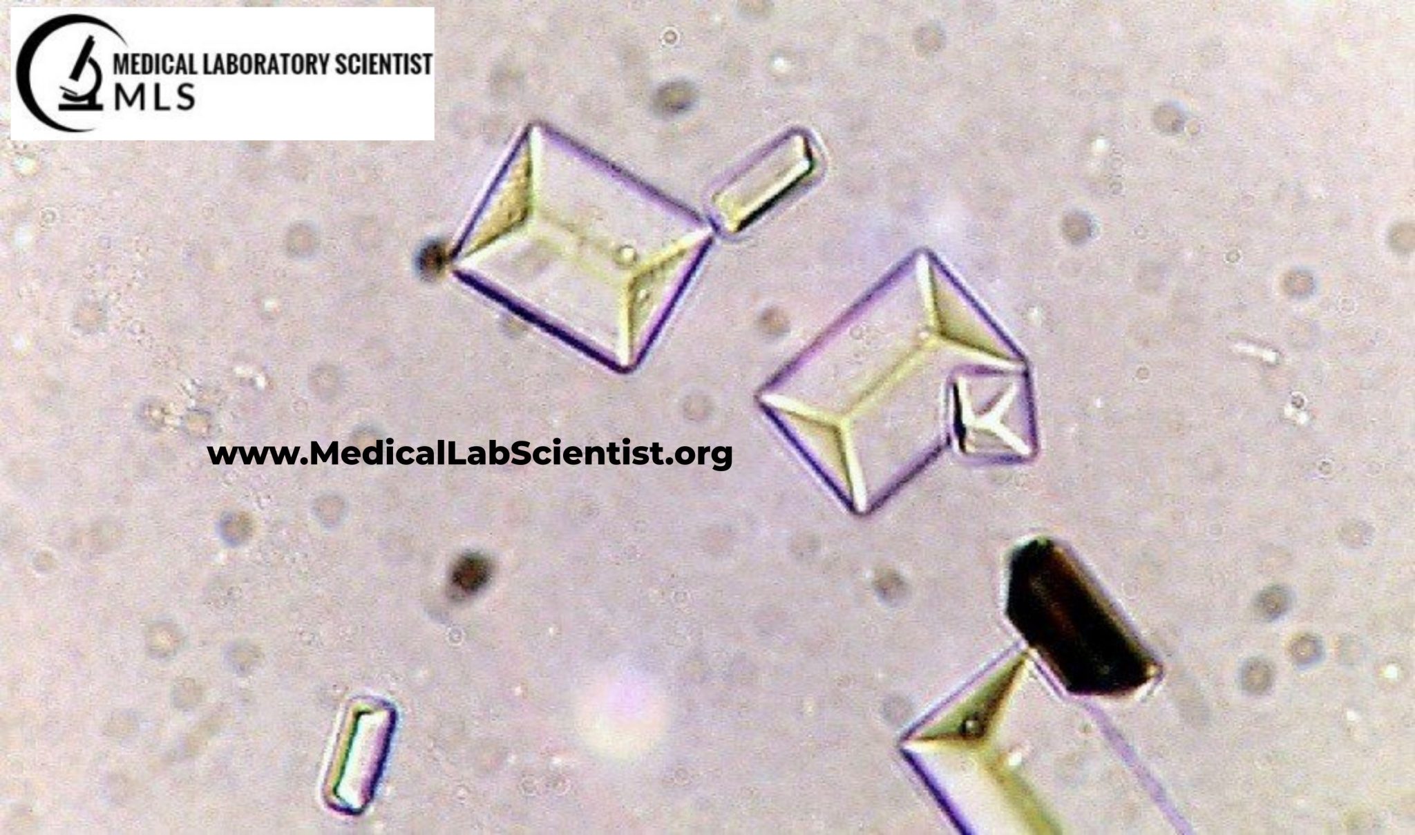 MICROSCOPIC URINALYSIS - Medical Laboratory Scientist MLS